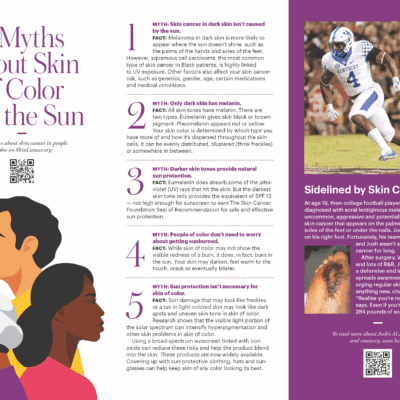 Skin Cancer & Skin of Color – The Skin Cancer Foundation Web Store